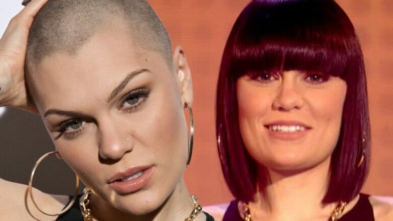 Jessie J flet hapur për gjendjen e saj shëndetësore: Flokët po më bien ...